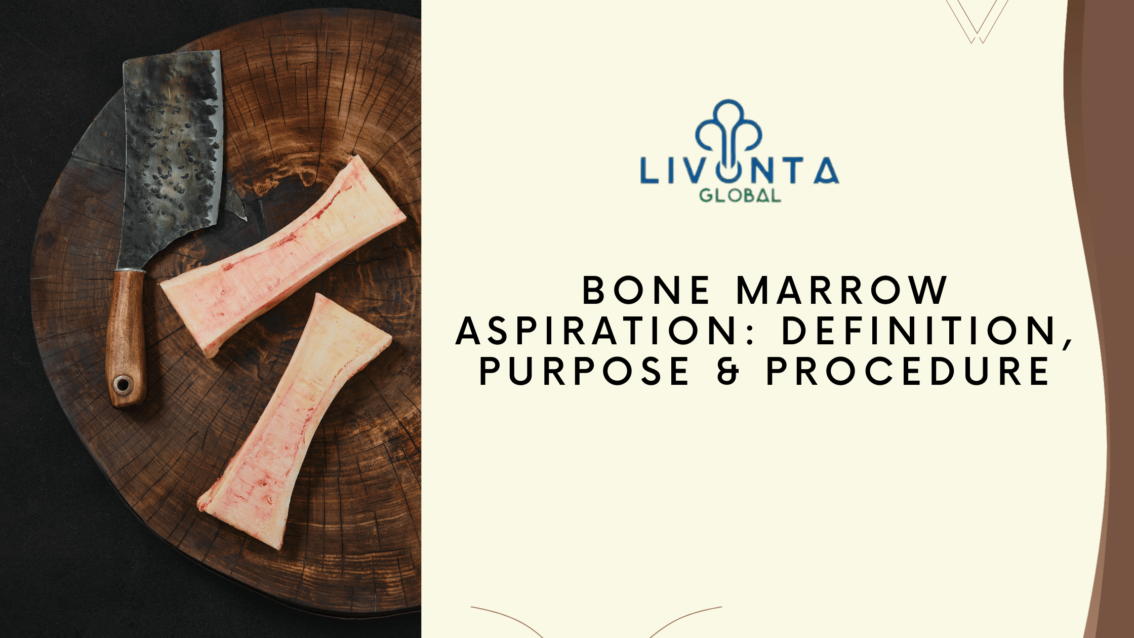 Bone Marrow Aspiration: Definition, Purpose & Procedure - Livonta ... Bone Marrow Aspiration: Definition, Purpose & Procedure - Livonta ...